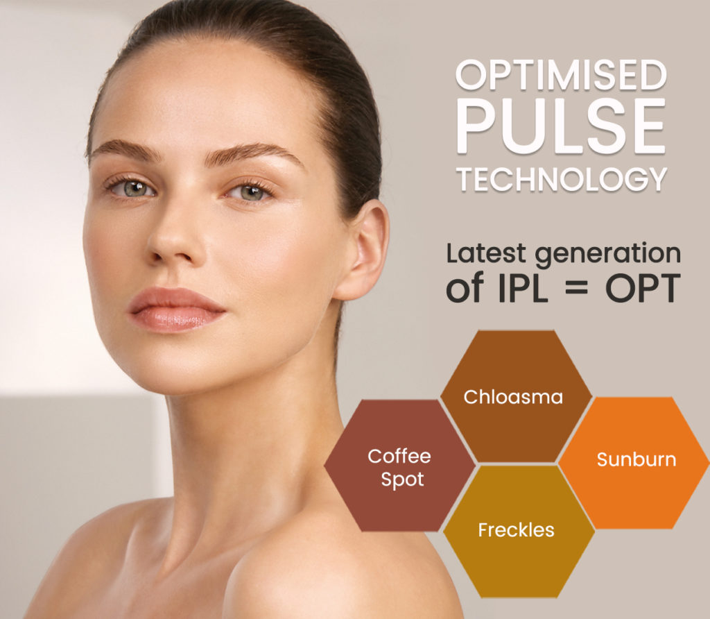 Optimised Pulse Technology (OPT) | Beauty salon in Toa Payoh